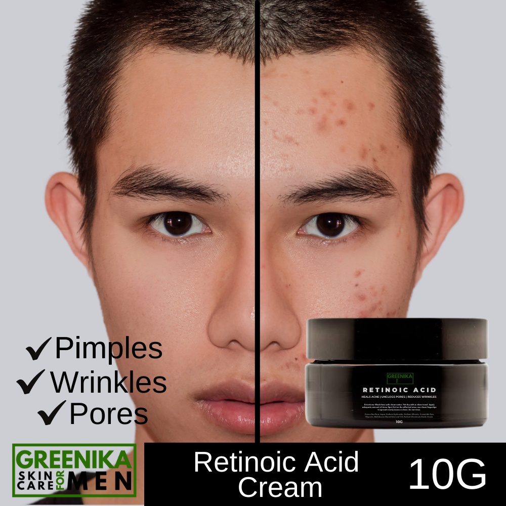 Greenika For Men Retinoic Acid Cream Minimize Wrinkles Fade Dark Spots ...
