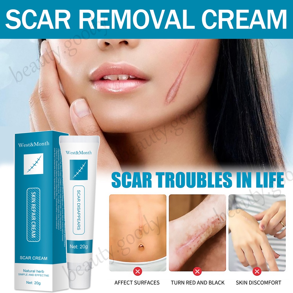 Scar Remover Cream Repair Scar removal Stretch Mark cream Peklat ...
