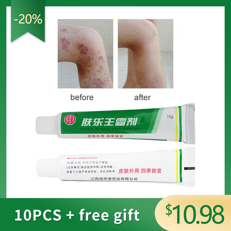 ♘Psoriasis-Cream Soap Ointment-Treatment Eczema Fulewang-Skin Dermatitis 10pcs No-Box | BeeCost