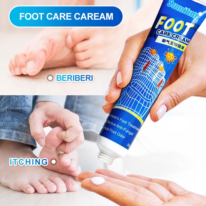 Anti Fungal Infection Foot Cream Foot Pain Relief Beriberi Itch Erosion ...