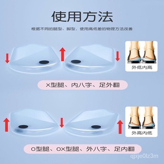 O-shaped leg correction straight leg insole, inner eight o-shaped leg ...