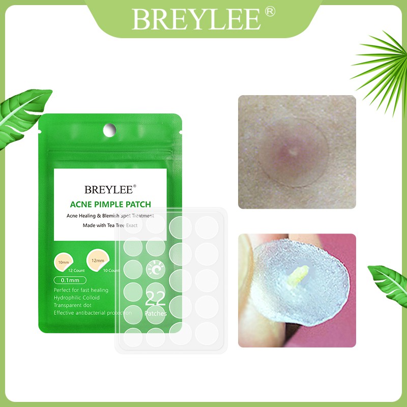 BREYLEE Acne Pimple Patch Acne Treatment Stickers Blemish Face Mask ...
