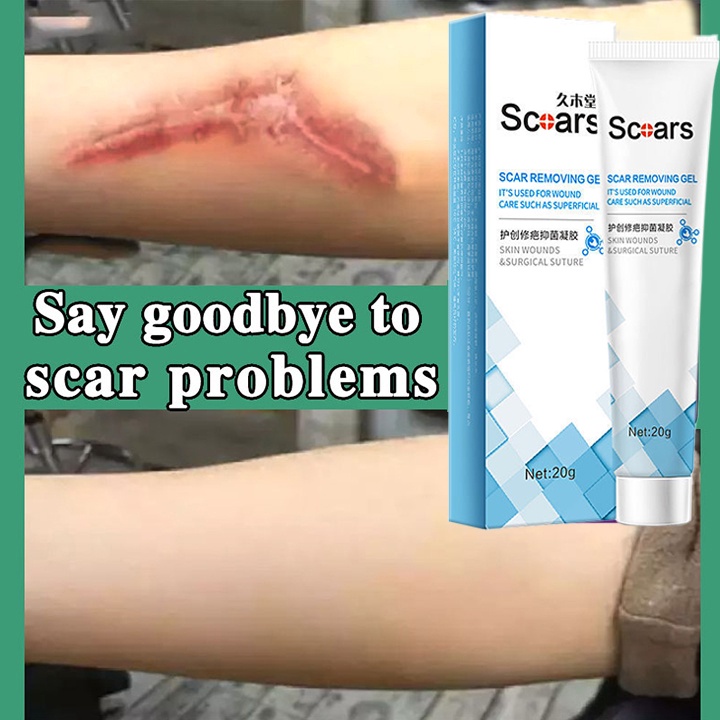 Scar Repair Gel Scar Remover Removal of old and new scars on body Acne ...