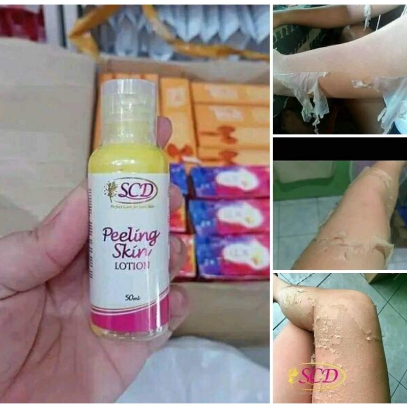 SCD PEELING SKIN LOTION ORIGINAL 50ML | Shopee Philippines
