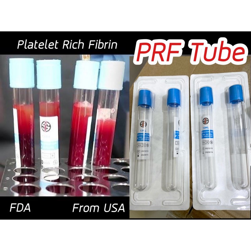 It is per 1 tube, PRP tube: PRF tube, PRF tube, PRF blood tube, 2 tubes ...