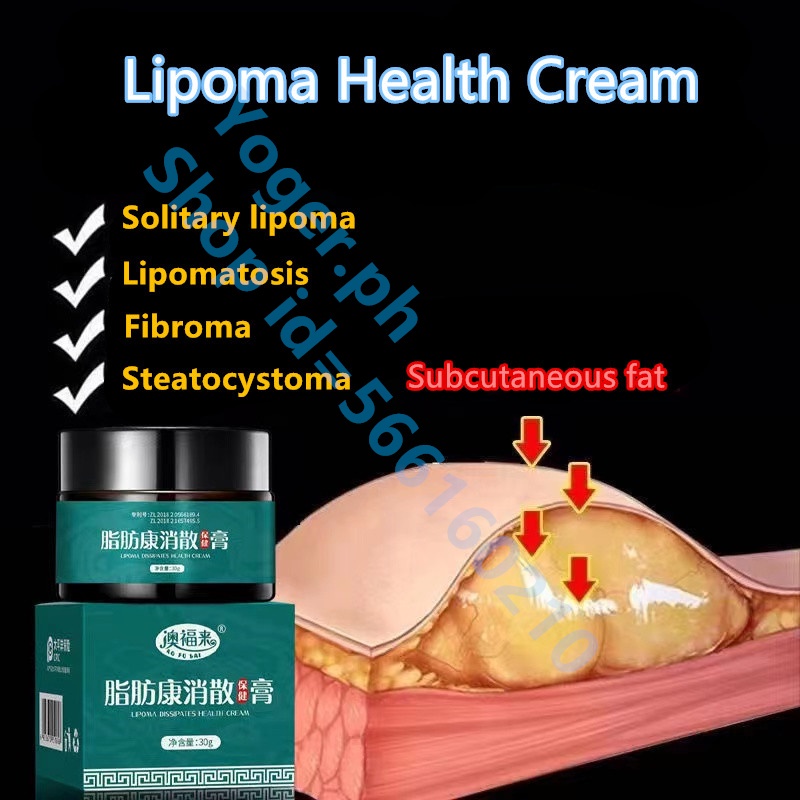 30g/box Lipoma Removal Cream Specially Treat Lipoma Lipomatosis Fibroma ...