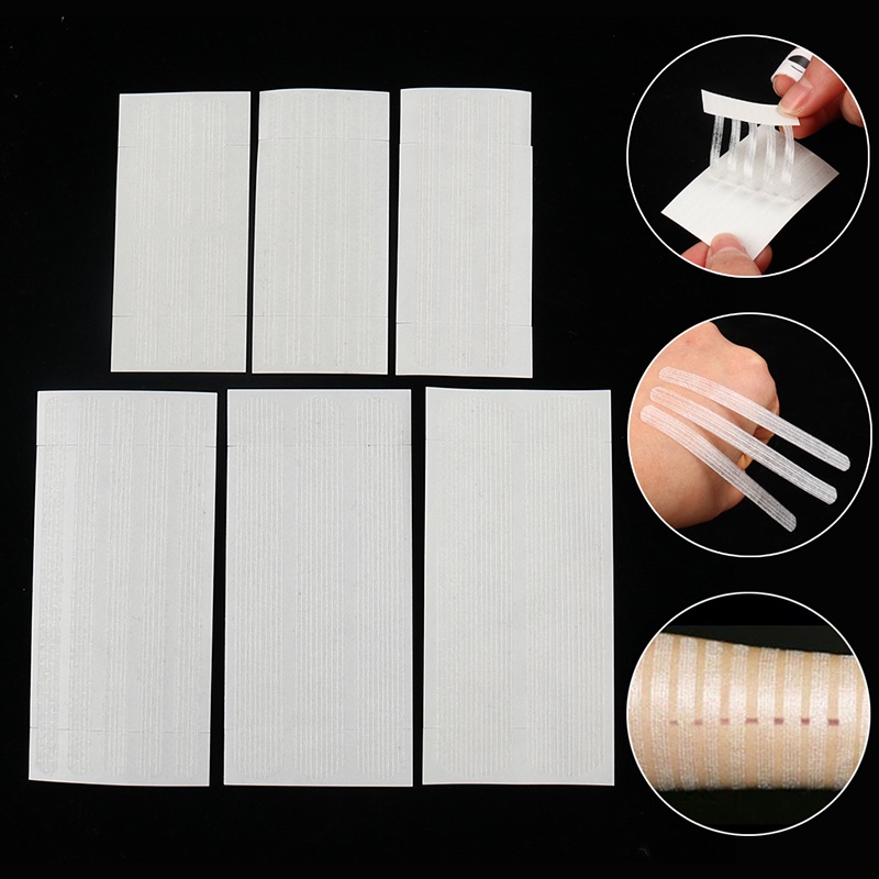 Sterile First Aid Wound Skin Closures Surgical Adhesive Steri Strip ...