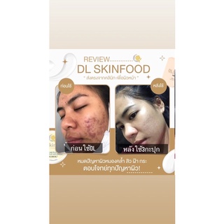 DELI SKIN NIGHT CREAM FOR ACNES/MELASMA/ DULL SKIN FROM THAILAND (5g ...