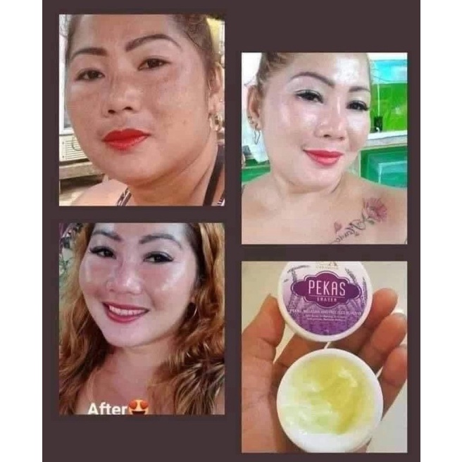 Pekas Eraser Cream Capadosa (With Freebies ) | Shopee Philippines