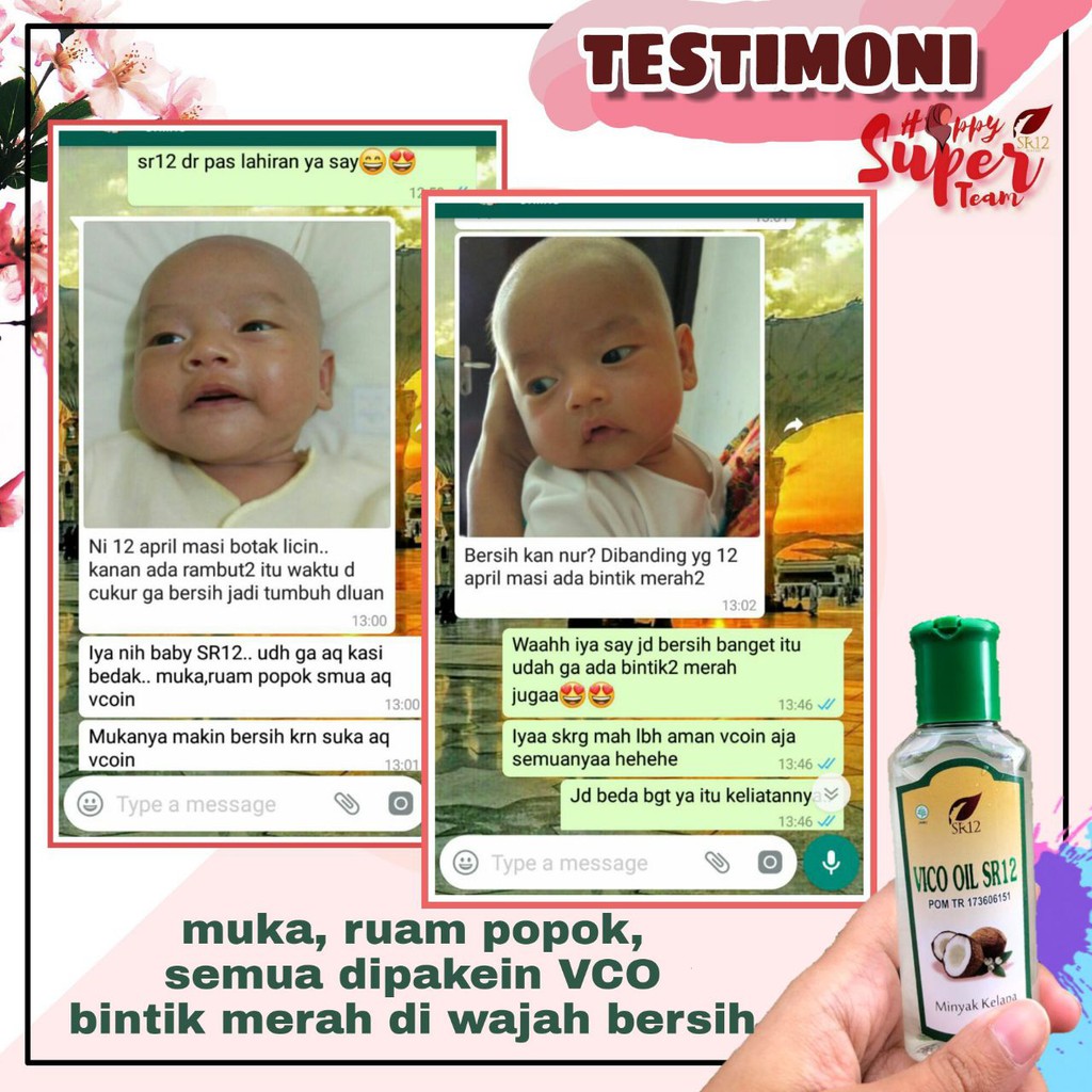 Coconut Oil Vco Sr12 Cream Red Rash Rash Cream For Traditional Baby ...