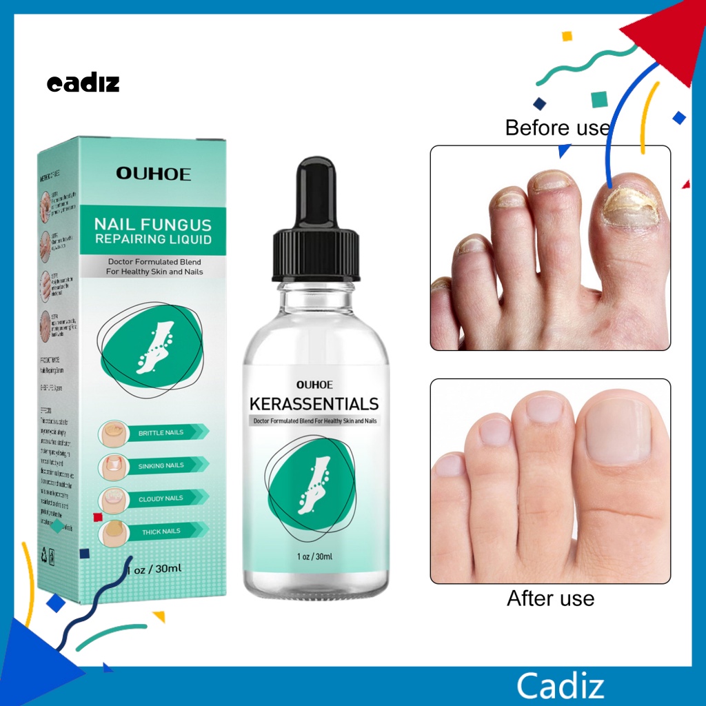 CADI Effective Nail Nutrient Solution Nail Care Repair Lotion ...