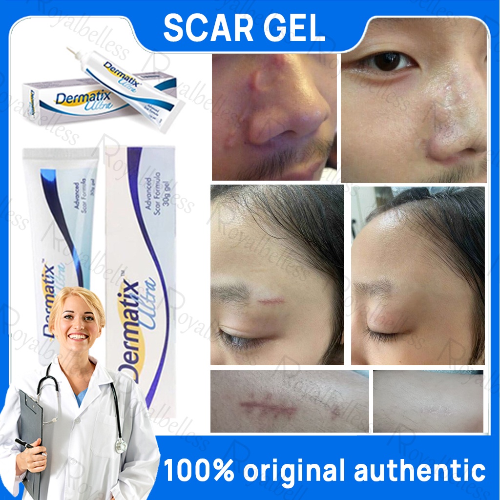 Australia Dermatix Scar Gel Acne Scars Treatment Scar Removal Cream