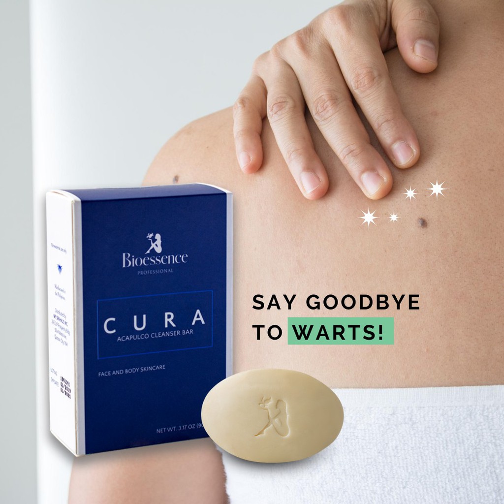 BIOESSENCE CURA ANTI WARTS SOAP | Shopee Philippines