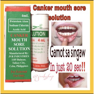 Canker mouth sore solution 4ml/singaw treatment | Shopee Philippines