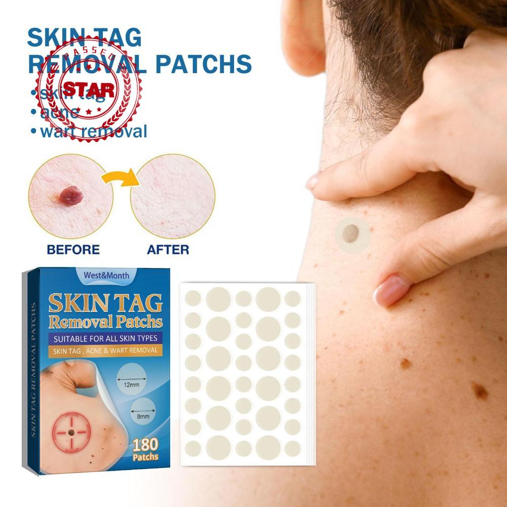 180 Patches Skin Tag Remover Patch Wart Treatment Stickers Gel Tools ...