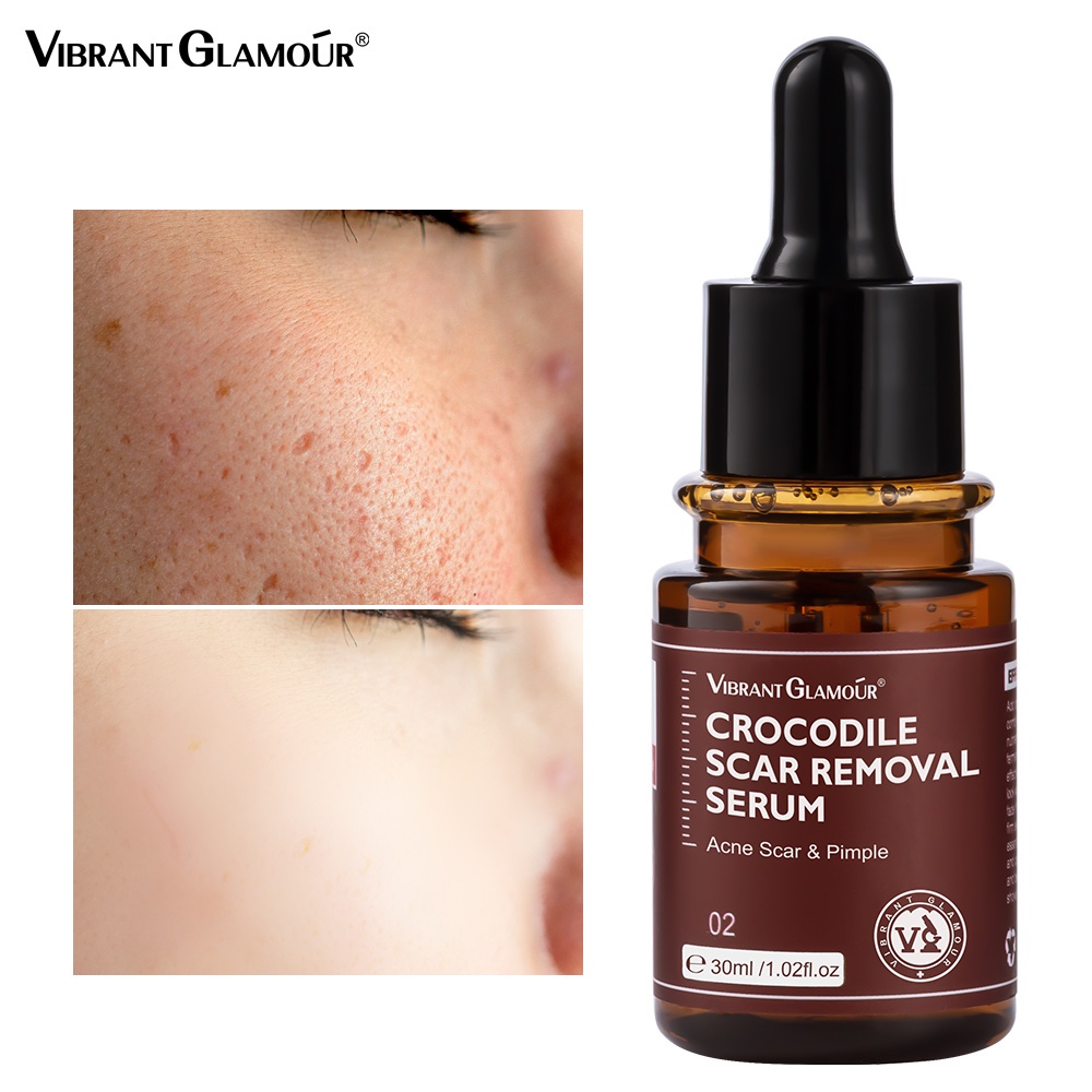 VIBRANT Glamor Crocodile Scars Repair Serum Acne Treatment Stretch ...