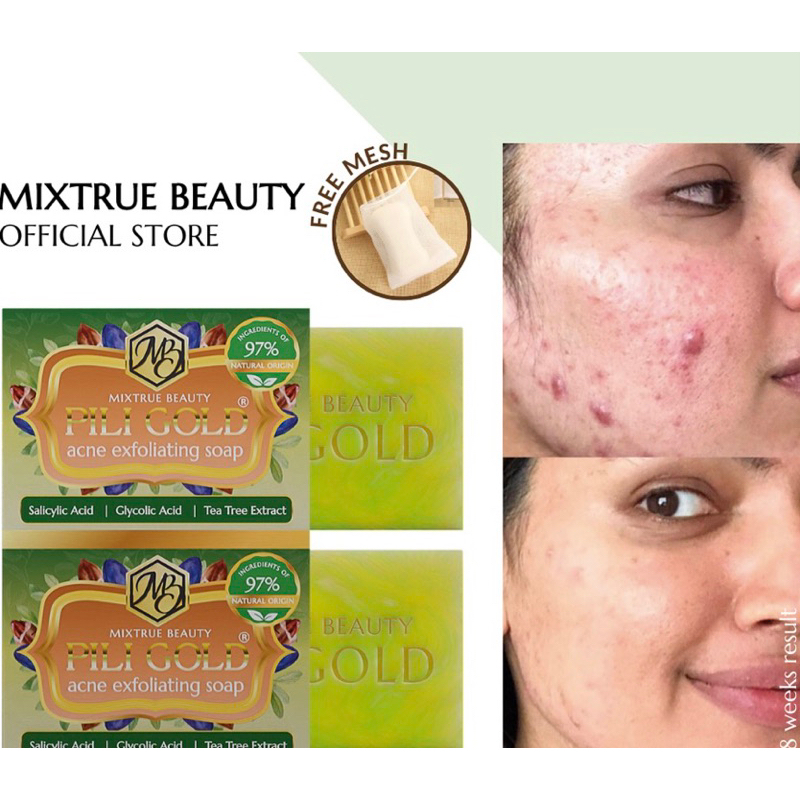 Pili Gold Acne Exfoliating Soap | Shopee Philippines