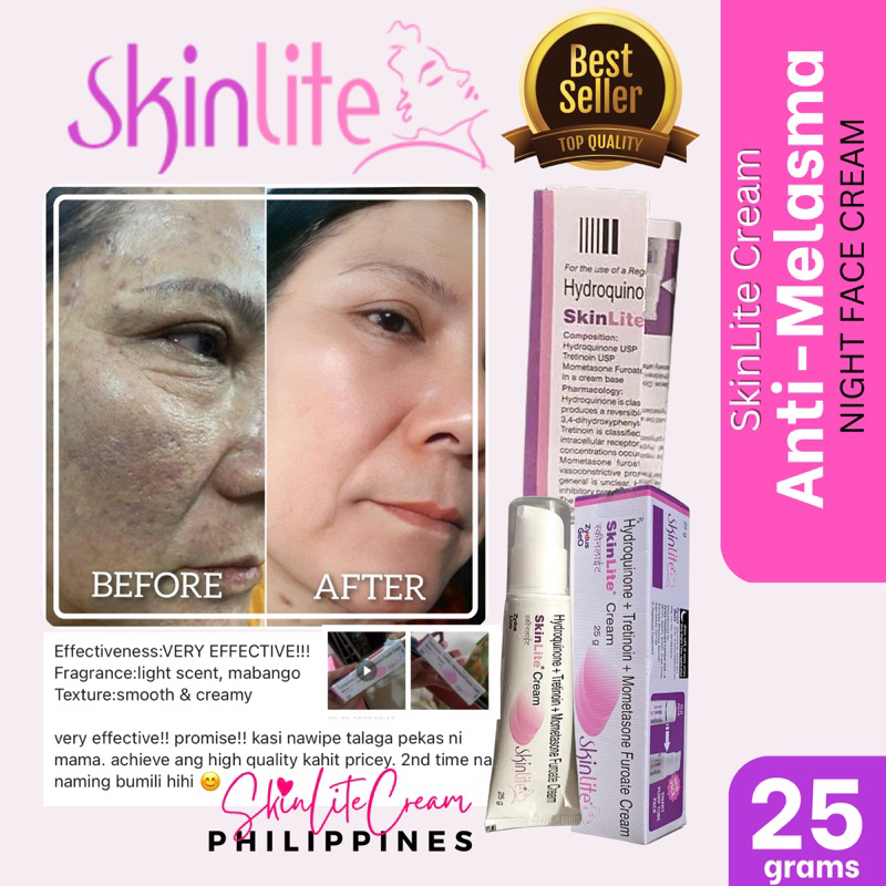 SkinLite Cream Philippines, Online Shop | Shopee Philippines