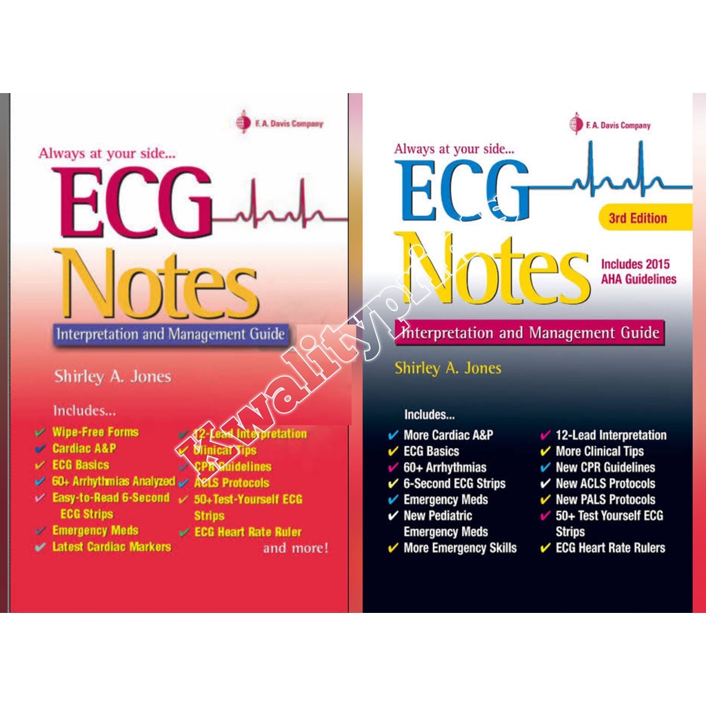 ECG NOTES INTERPRETATION AND MANAGEMENT GUIDE : 2ND & 3RD EDITION ...