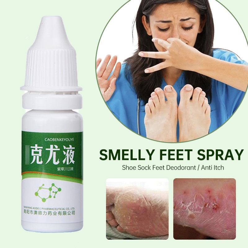Wart Remover Spray Treatment Removers Anti Wart Mole Foot Corn Medical ...