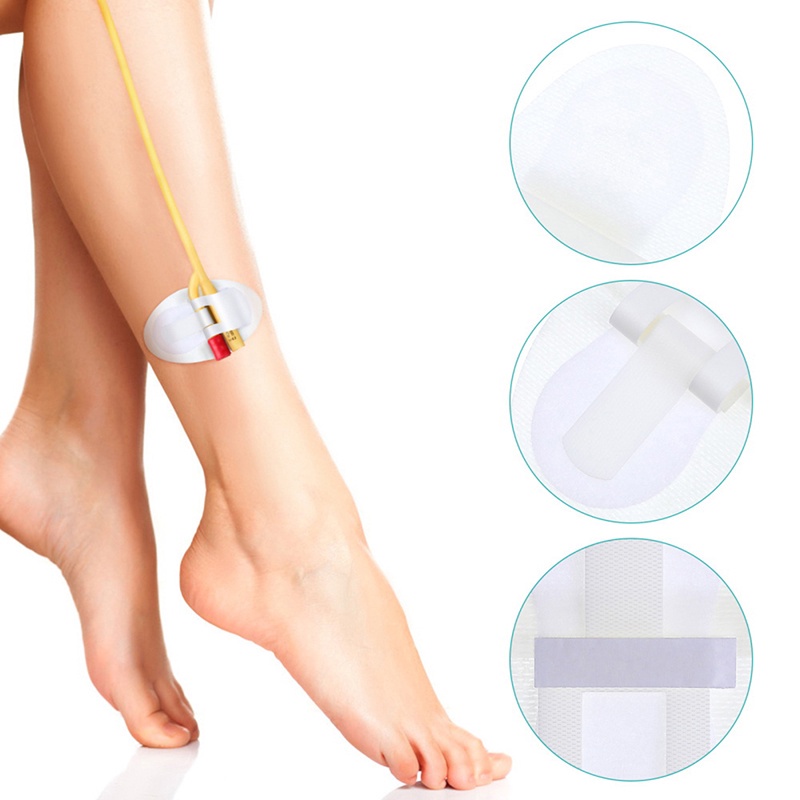 Disposable Tube Fixing Stickers Catheter Stickers Catheter Drainage ...