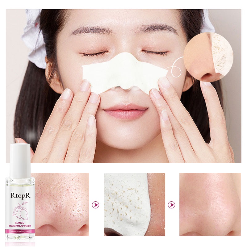 RtopR Mango Blackhead Remover Mask Deep Cleans Pores Acne Treatment ...