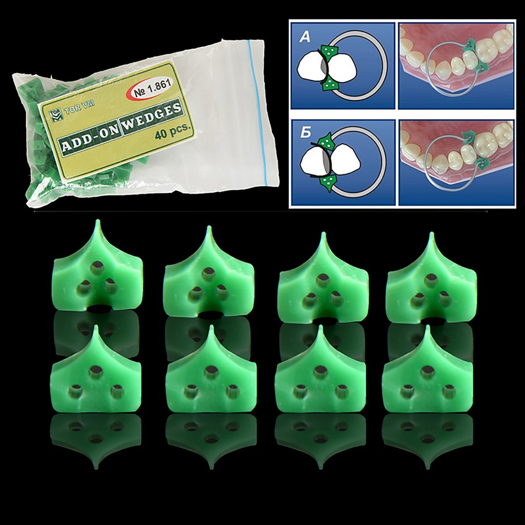 40 pcs Matrix Sectional Contoured Metal Matrices Wedges | Shopee ...