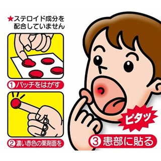 Japan Taisho Pharmaceutical Oral Ulcer / Canker Sore Sticker / Patch ...