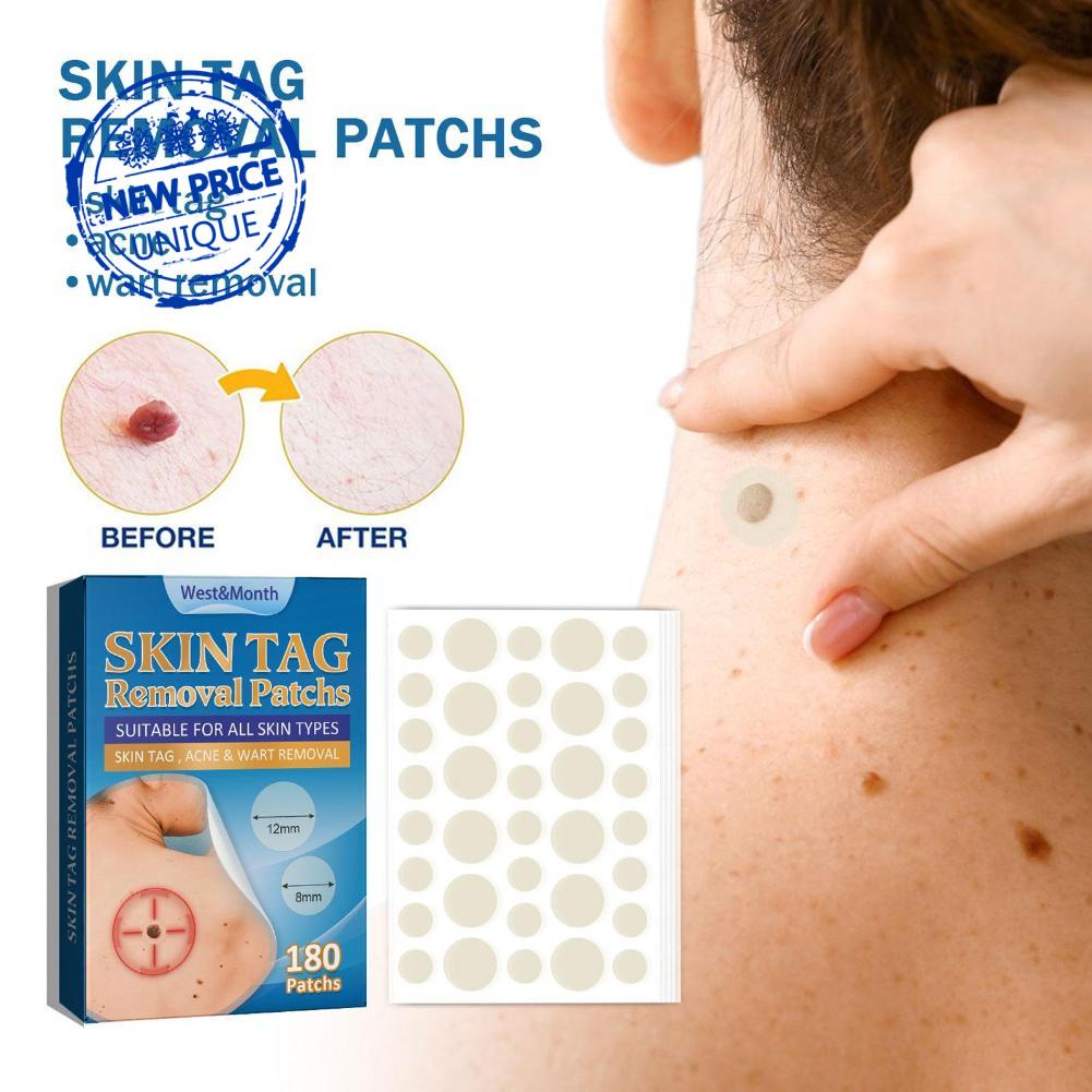 180 Patches Skin Tag Remover Patch Wart Treatment Stickers Invisible ...
