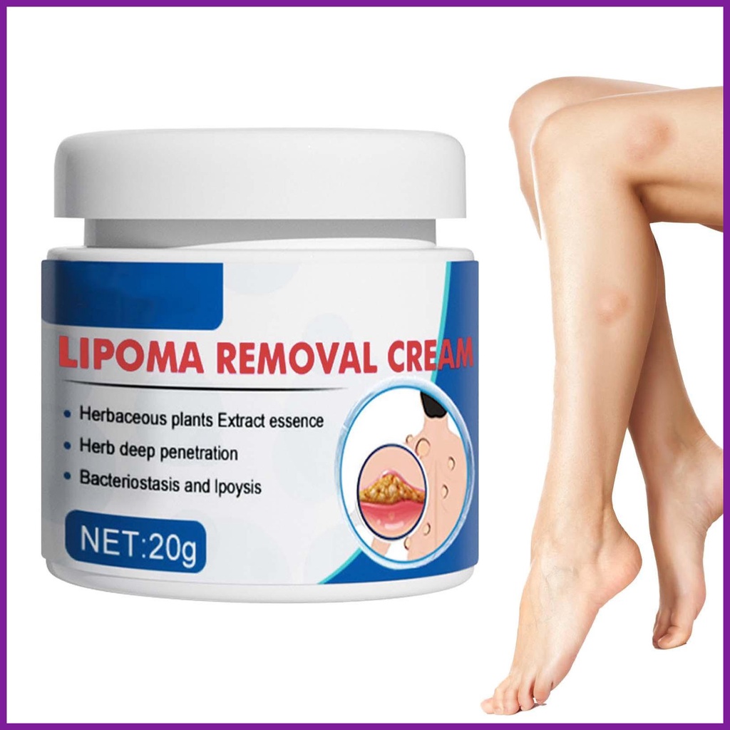 Lipoma Care Cream Lipolysis Removal Skin Fat Swelling Hurt Ointment ...