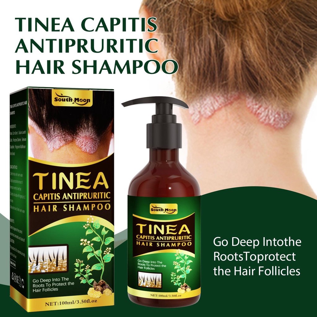 Scalp Folliculitis Refreshing Maintenance Scalp Shampoo Tinea Capitis ...