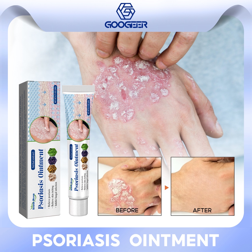 South Moon Antibacterial Psoriasis Cream Herbal Effective Anti Itch