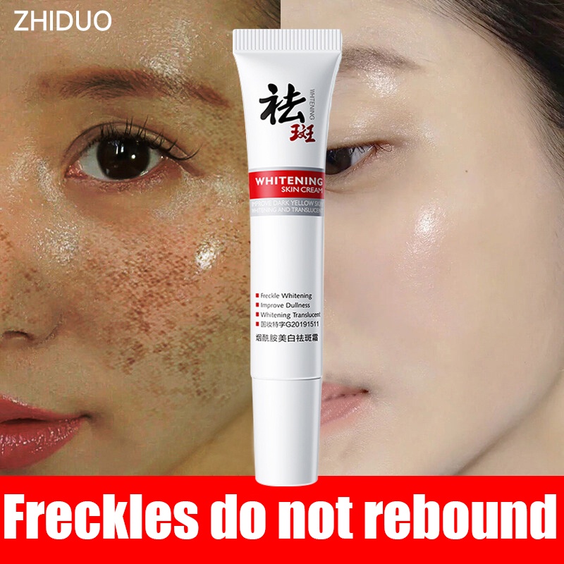 20g Melasma Remover Cream Pekas Remover Original Dark Spot Freckles ...