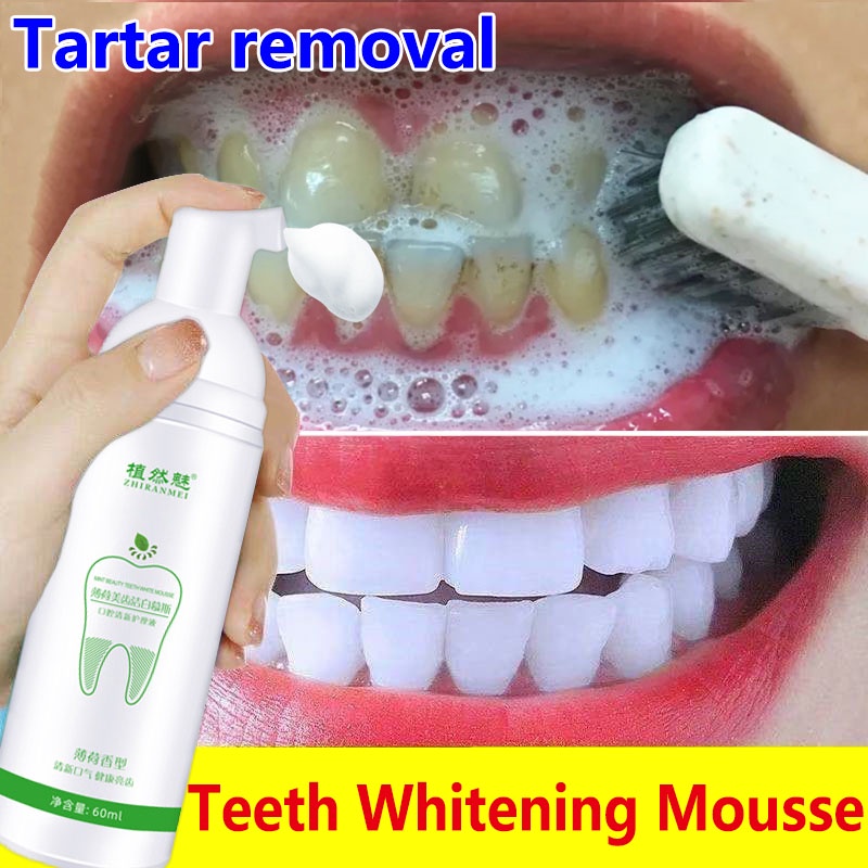 Teeth whitening mousse toothpaste Remove Tartar Remove Plaque Oral Odor ...