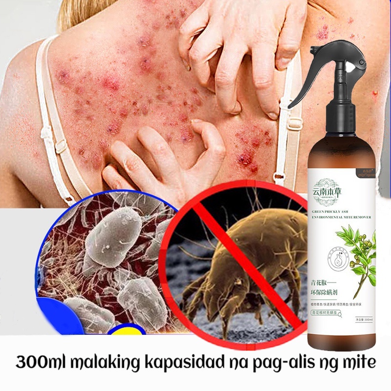 SENLOVE 300ML Mite Spray Bed Bug Killer Dust Mite Remove Spray Natural ...