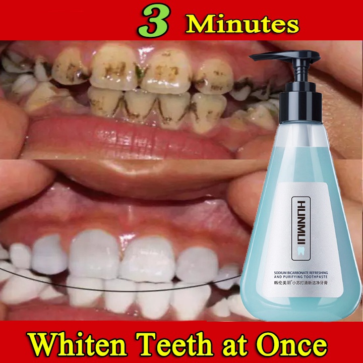 { ORIGINAL } Genuine Hunmui Toothpaste, Fragrant Liquid Toothpaste ...