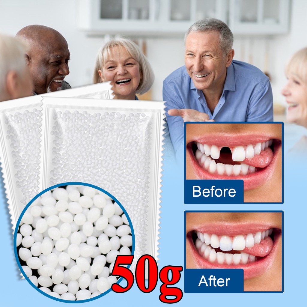 50g Temporary Tooth Repair Kit Teeth and Gaps Moldable Falseteeth Solid ...