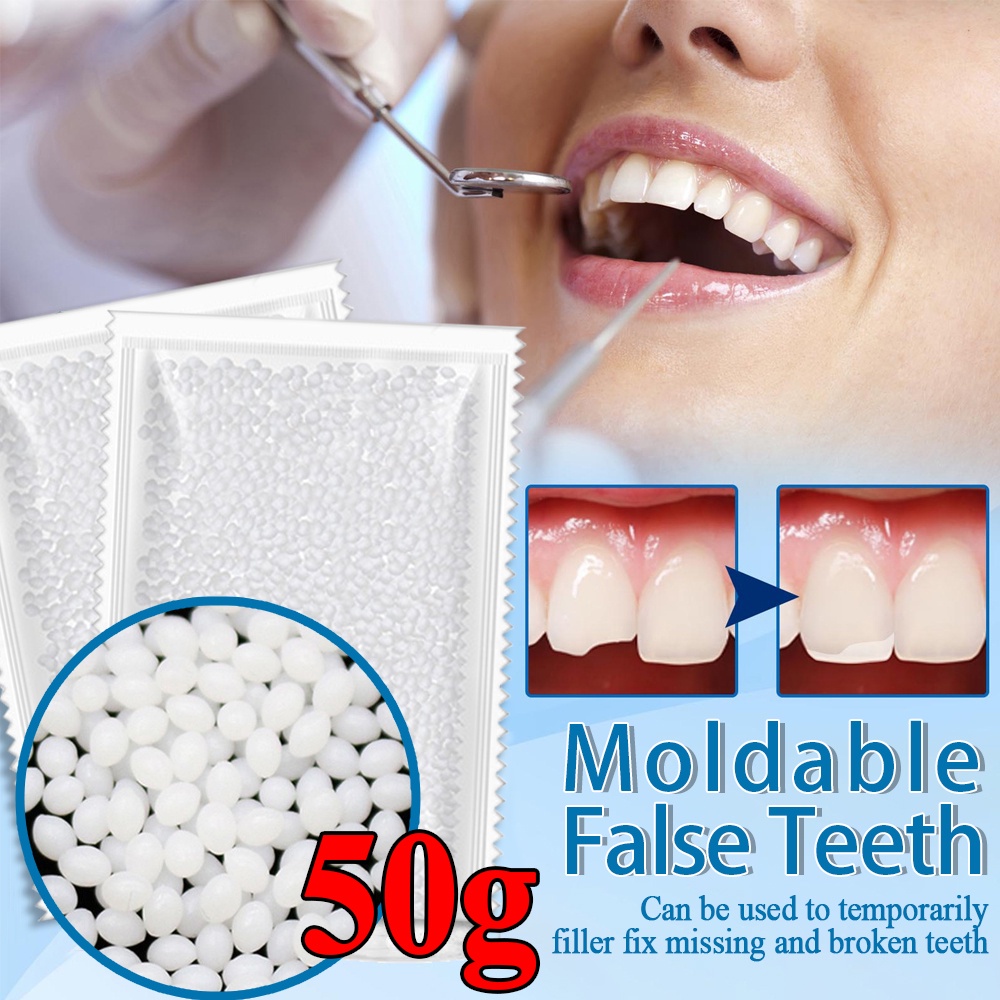 50g Temporary Tooth Repair Kit Teeth and Gaps Moldable Falseteeth Solid ...