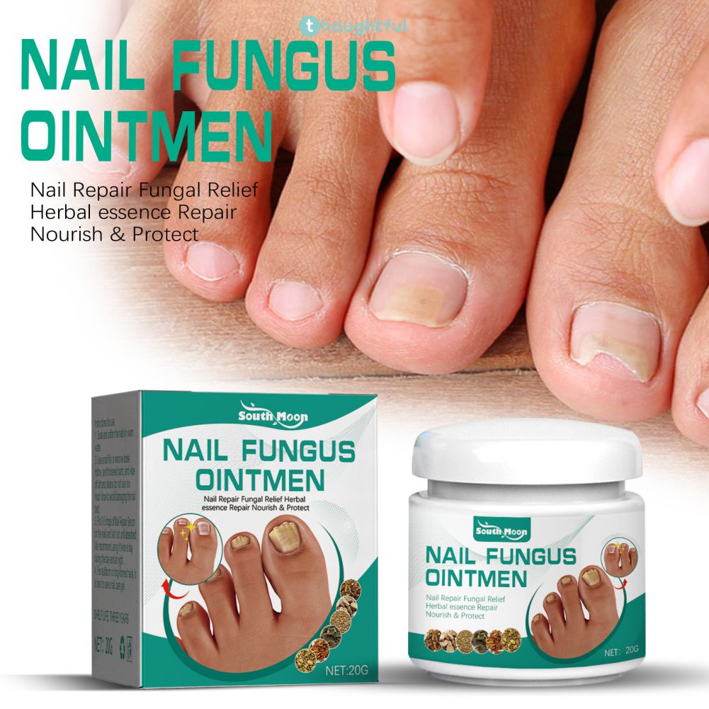 South Moon 20g Toe Nail Fungus Treatment Cream Onychomycosis Paronychia