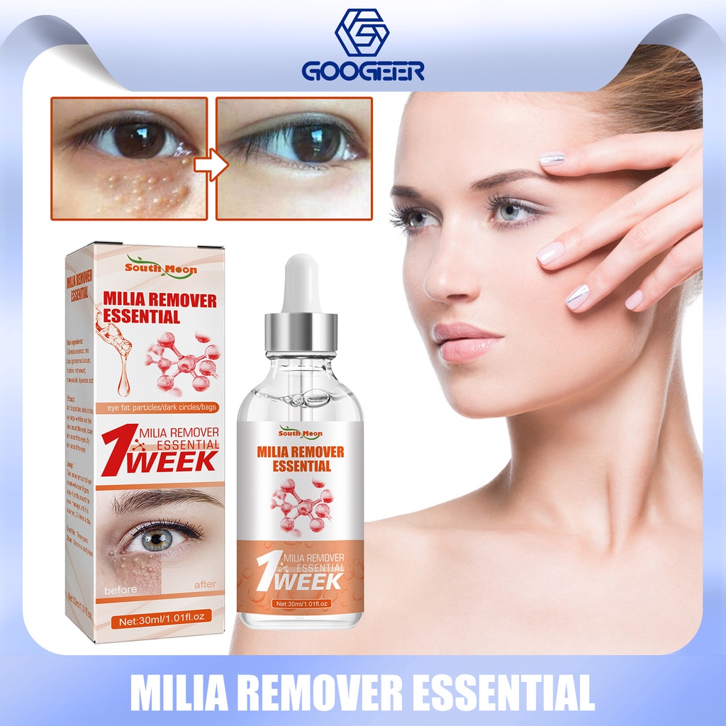 South Moon Milia Remover Essential Oil Eyes Fat Granules Removal Serum ...