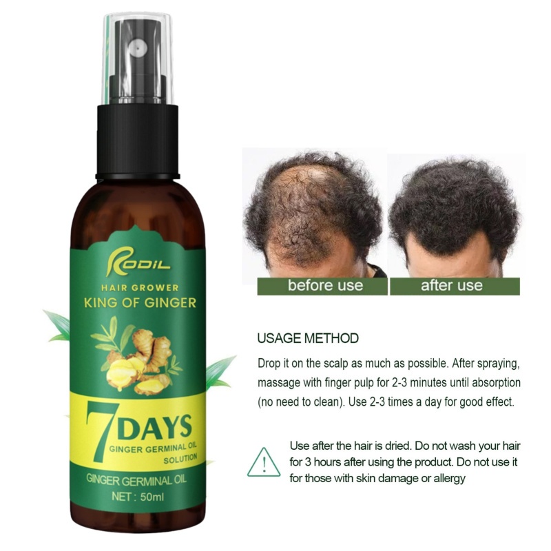 Rodil King Of Ginger Hair Nourishing Oil Controlling Serum 7 Days