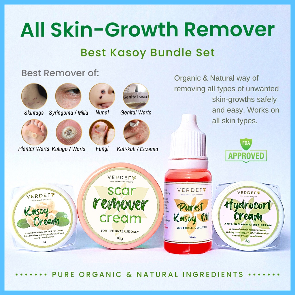 Original Warts, Kulugo, Mole, Nunal, Skintags, Milia, Syringoma ...