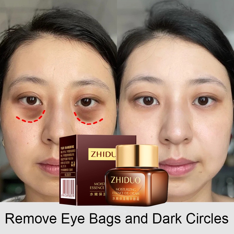 Eye Cream Eyebag Remover Eye Wrinkle Removal Cream Moisturize Anti ...