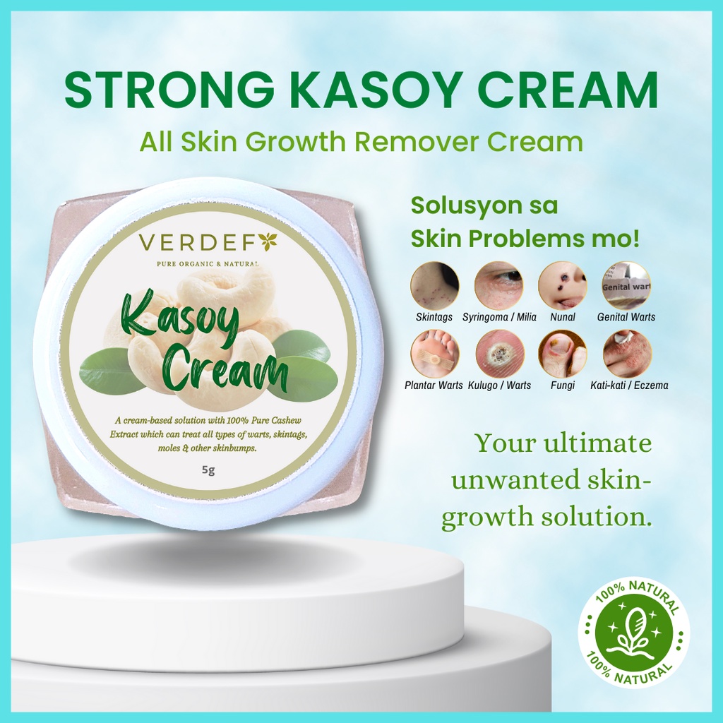 Strong Kasoy Cream ORGANIC, SAFE & EFFECTIVE Syringoma, Warts, Mole ...