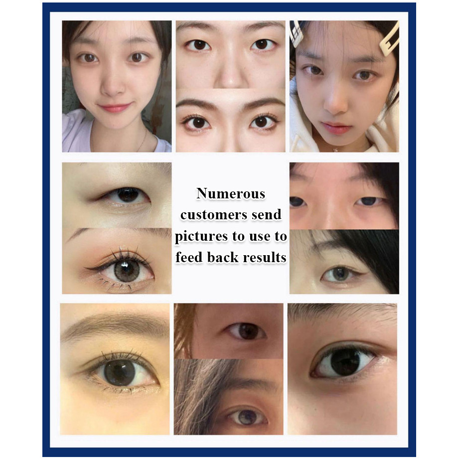 Shipping from PH&&Achieve Beautifully Defined Double Eyelids with Japan ...